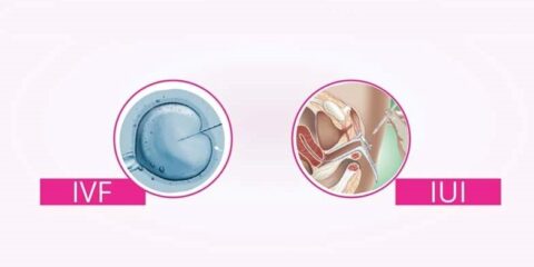 What is the Difference Between IUI and IVF? - Dr Hrishikesh Pai