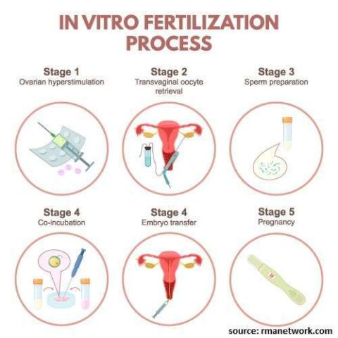 What is the Difference Between IUI and IVF? - Dr Hrishikesh Pai